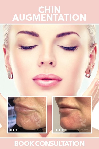 Blood Spot Removal - Hair Transplants of The Royal Liver Building