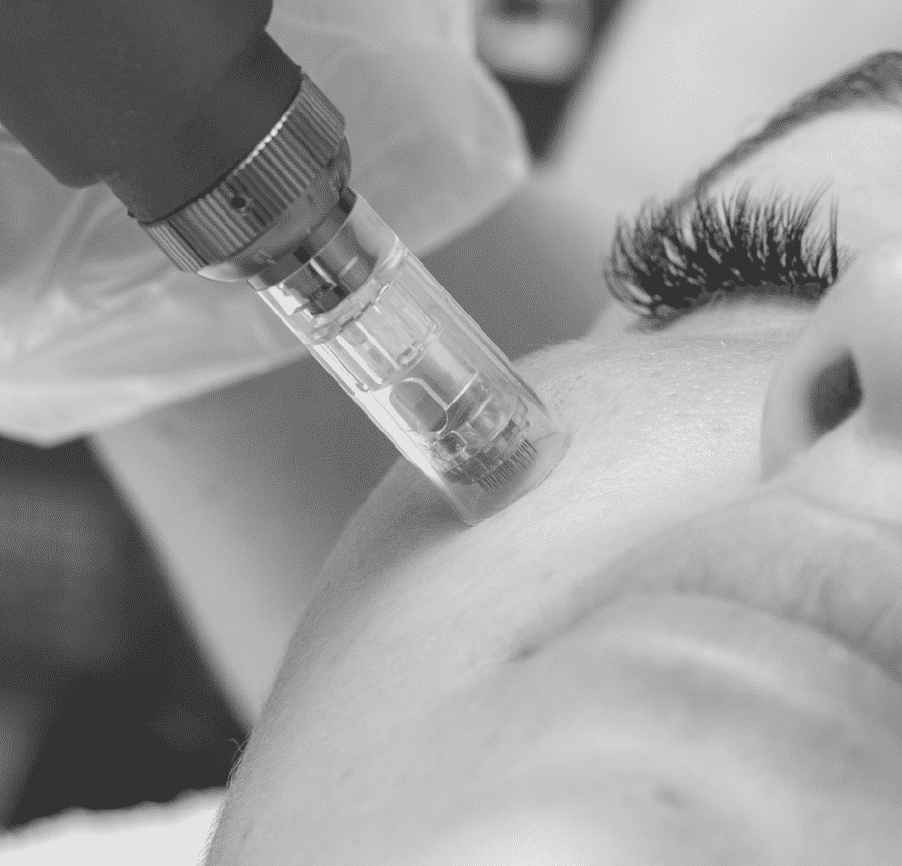 Sofwave | Non-Surgical Facelift | Incredible Skin Tightening