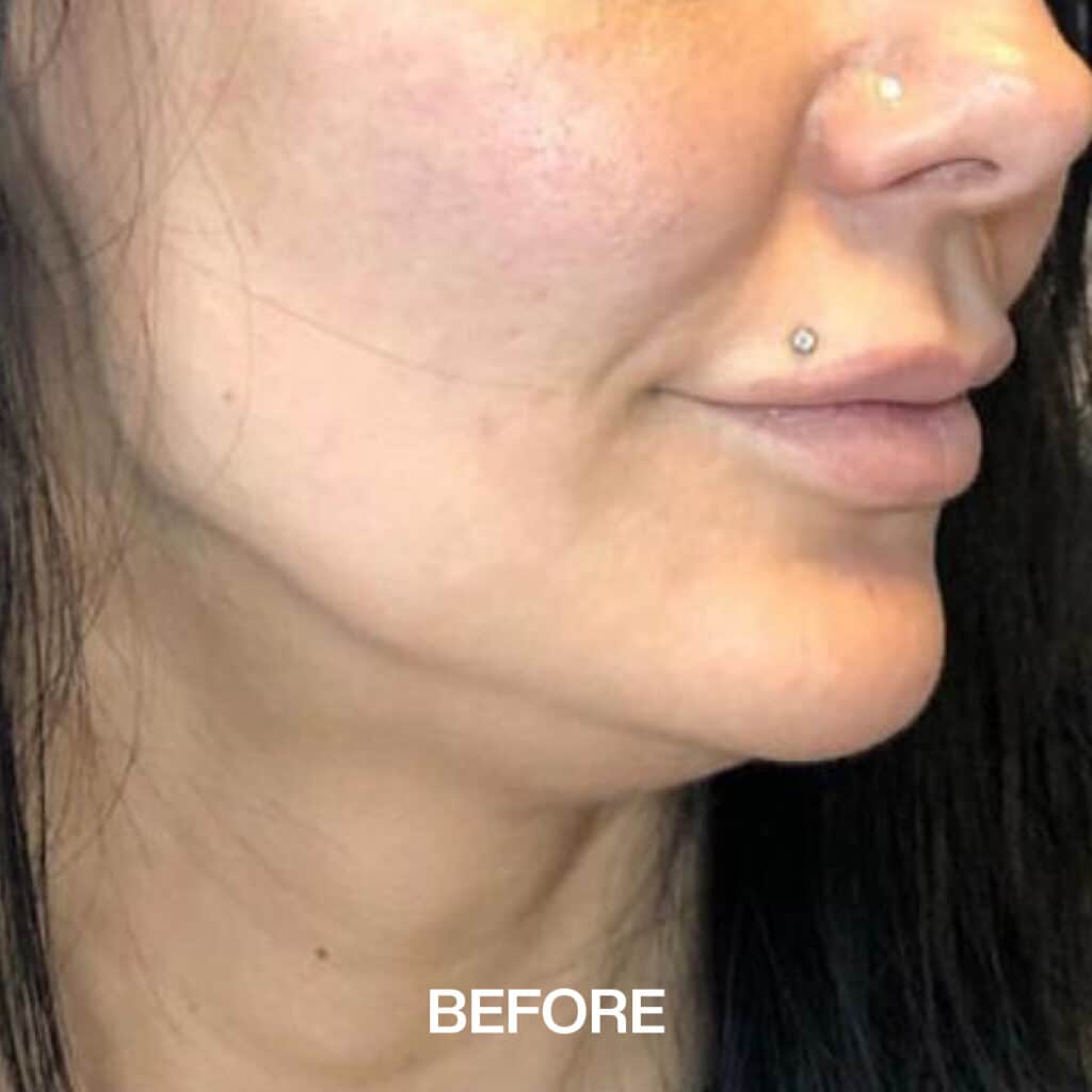 Skin Clinic in Liverpool | Aesthetics of Liverpool | Best Aesthetics ...