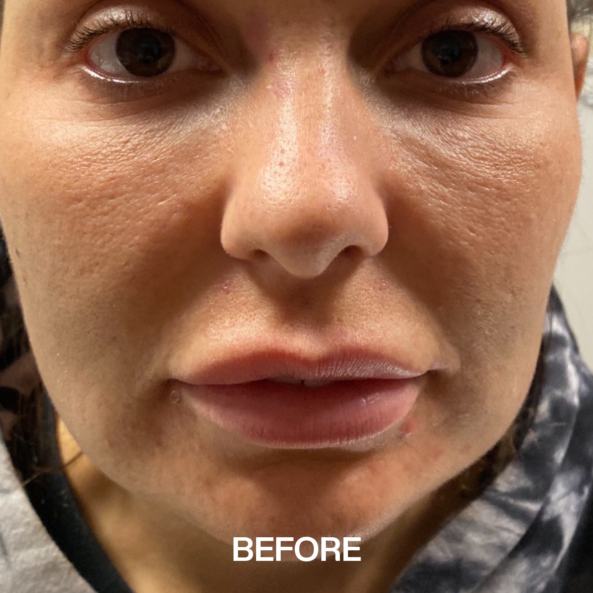 Skin Clinic in Liverpool | Aesthetics of Liverpool | Best Aesthetics ...