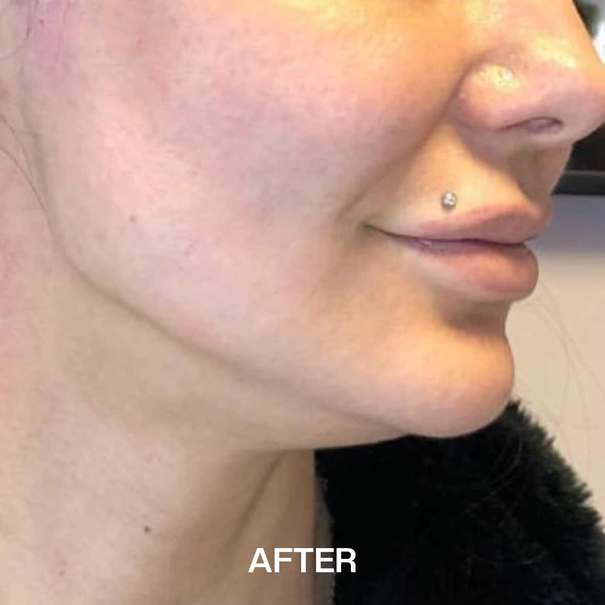 Skin Clinic in Liverpool | Aesthetics of Liverpool | Best Aesthetics ...