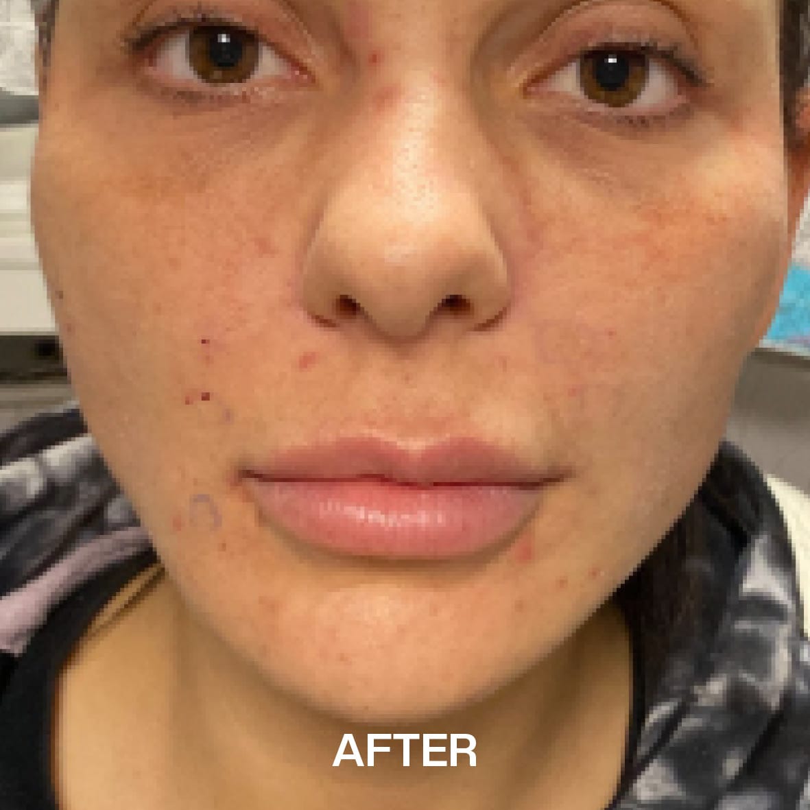 Skin Clinic in Liverpool | Aesthetics of Liverpool | Best Aesthetics ...