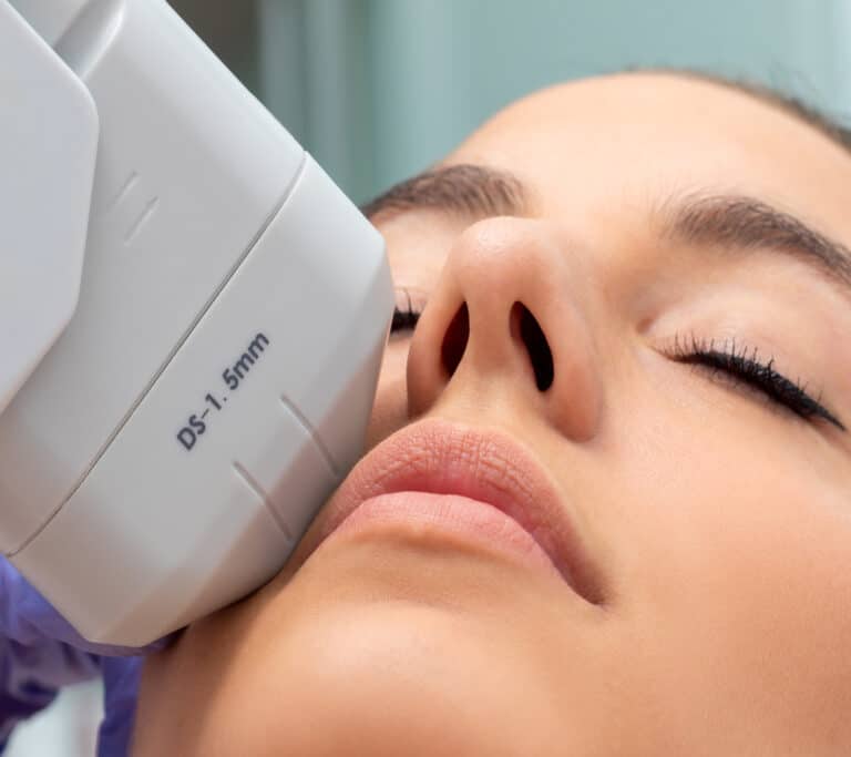 Intense pulsed light therapy | IPL photofacial