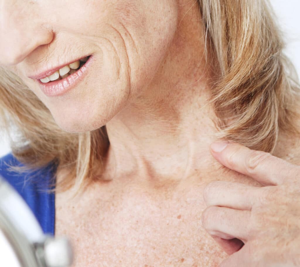 Non Surgical neck lift Liverpool | Non Surgical neck lift