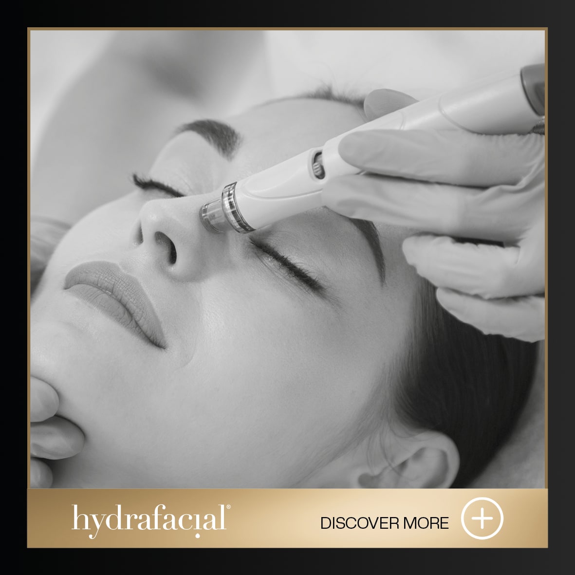 Diamond microdermabrasion Liverpool | Fabulous Exfoliation