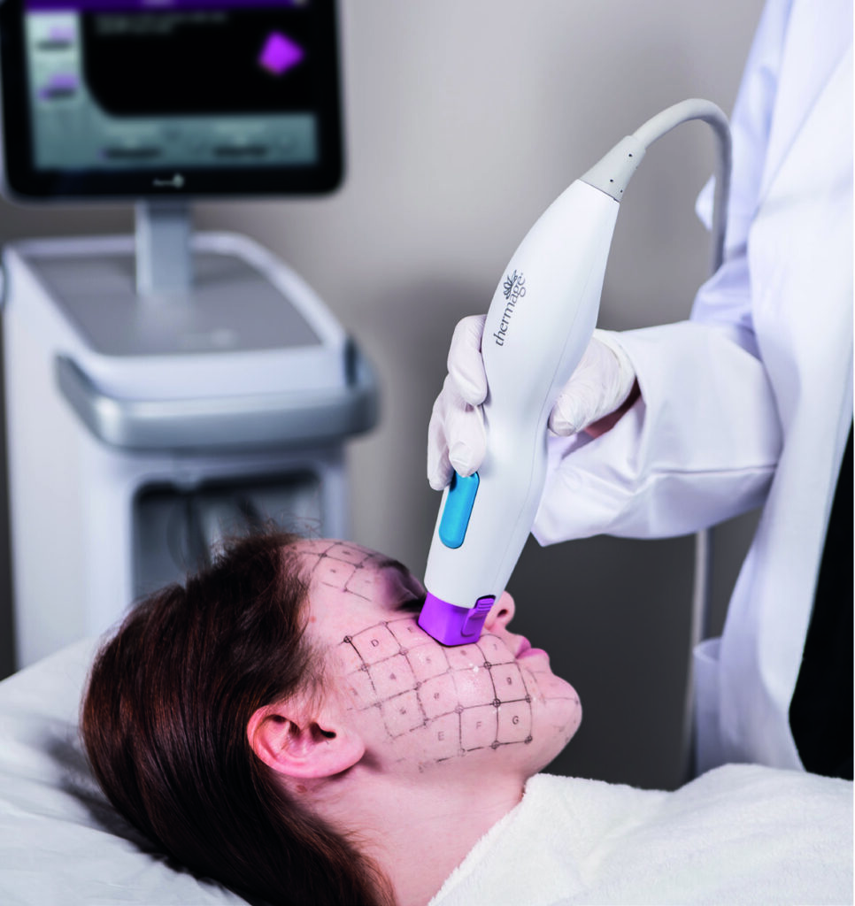 THERMAGE LIVERPOOL | SKIN TIGHTENING SECRETS FOR LOOSE SKIN