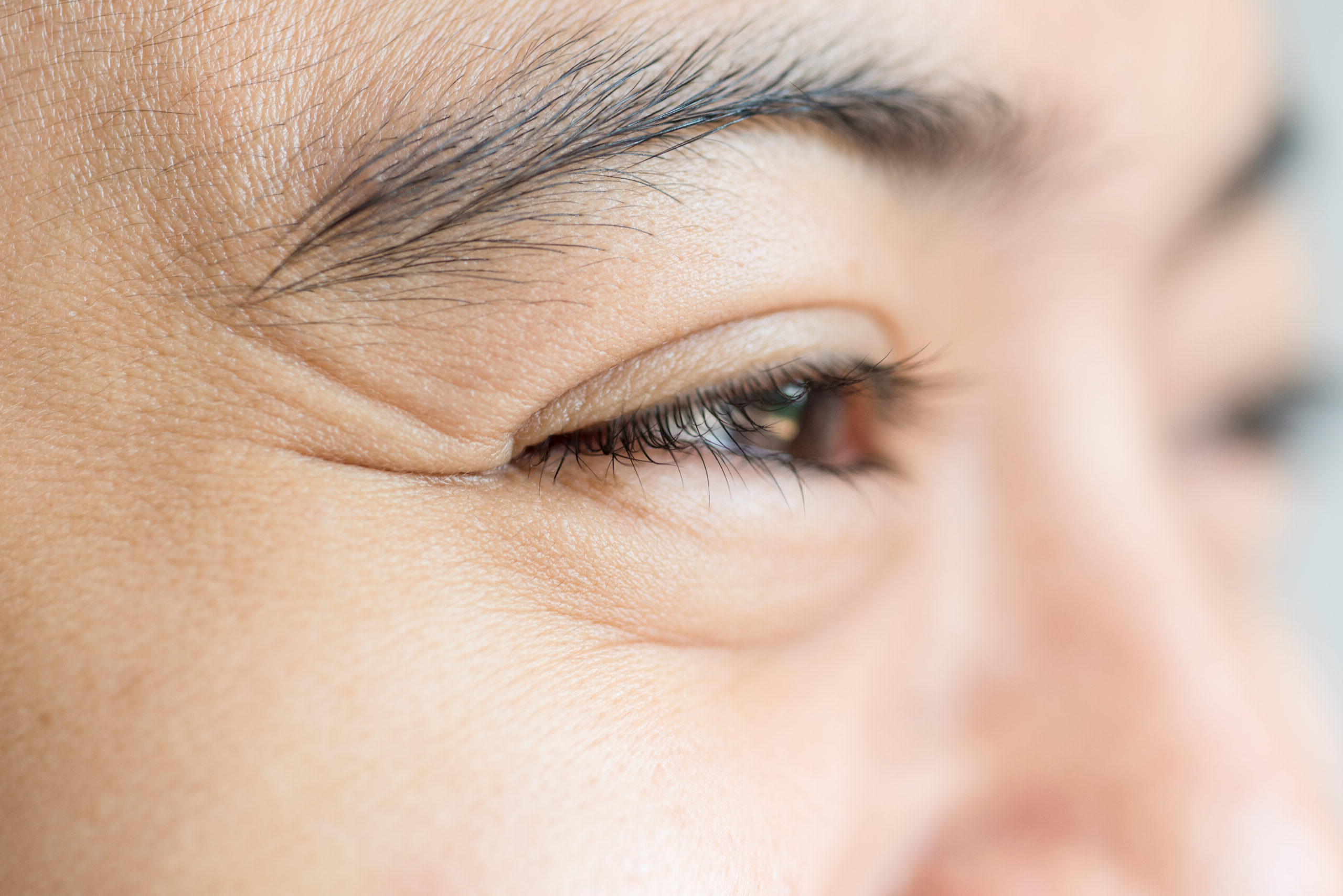 COOL LASER | BLEPHAROPLASTY LIVERPOOL